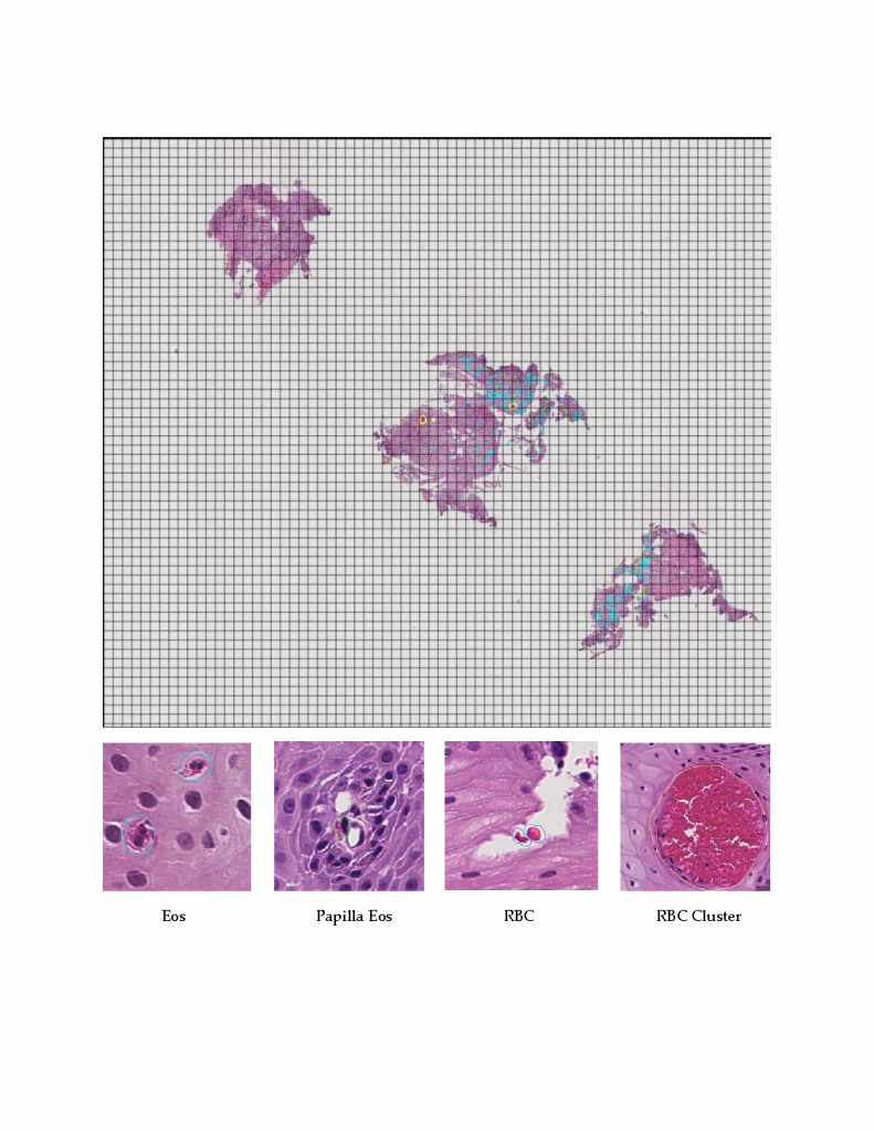 Eosinophilic Granulocyte Recognition on Whole Slide Imaging Using CircleSnake Deep Learning ...